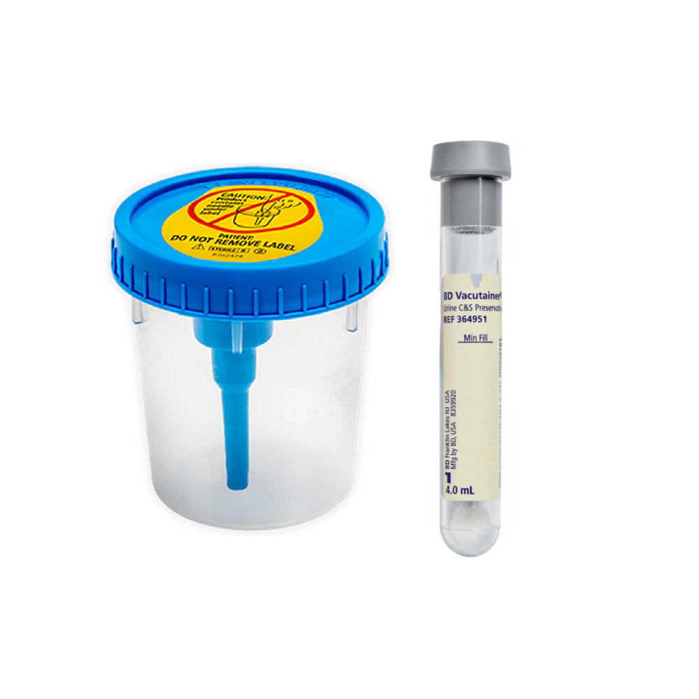 4mL BD Vacutainer Urine Collection Kit - Tube and Cup Combo Case of 50 – LabLink Direct